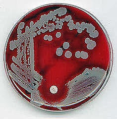 抗生素介紹 Part IV：戰勝超級細菌 MRSA 的新抗生素 - 科學，就是醬